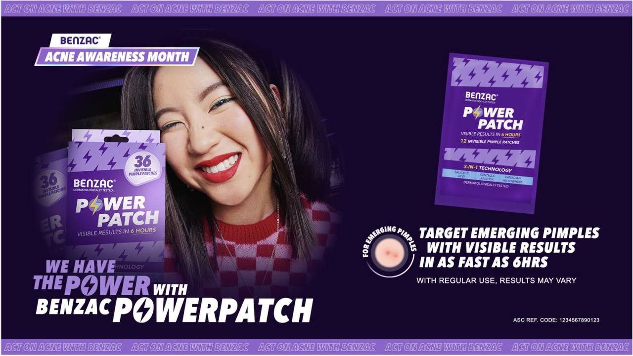 Clear It Up: Benzac Steals the Spotlight This Acne Awareness MONTH ...